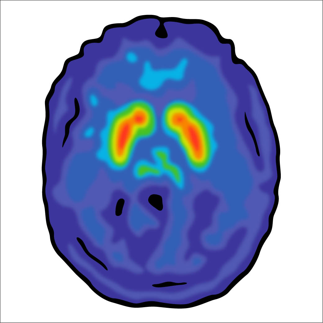Creating an information leaflet for FDOPA PET imaging – Graphical Science